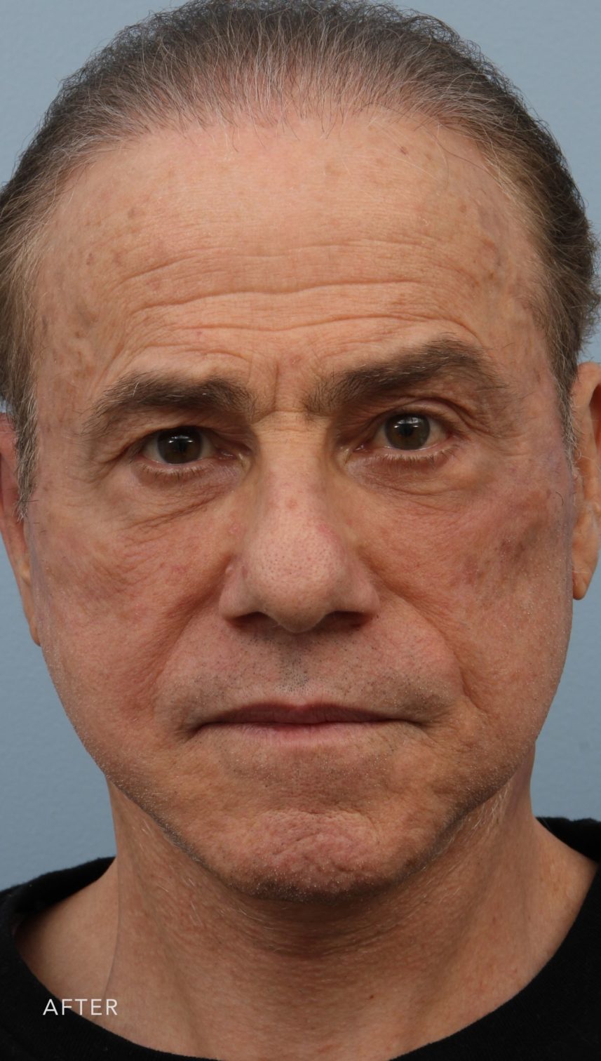 FL73 | Facelift Albany, Latham, Saratoga NY - Williams Center Williams ...