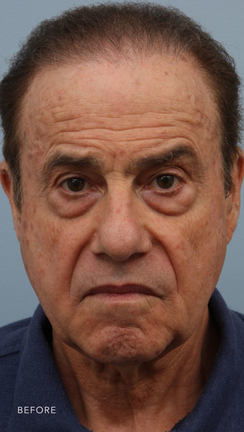 FL73 | Facelift Albany, Latham, Saratoga NY - Williams Center Williams ...