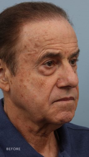 FL73 | Facelift Albany, Latham, Saratoga NY - Williams Center Williams ...