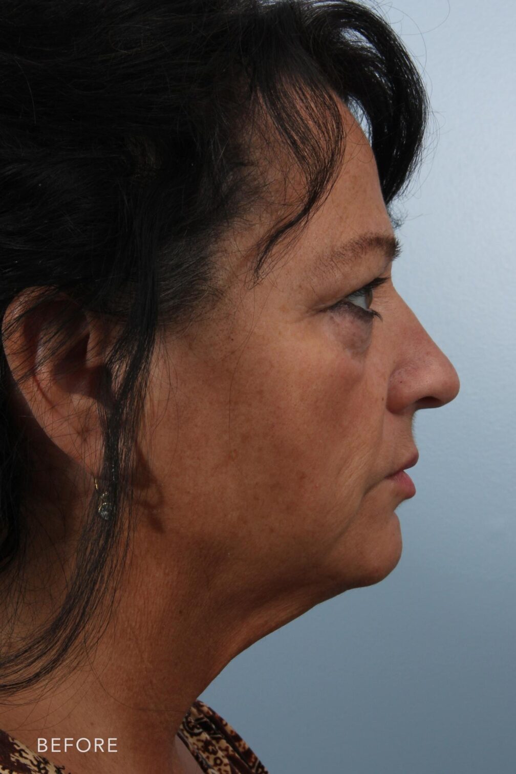 Facial Procedures Archives - Williams Center Williams Center