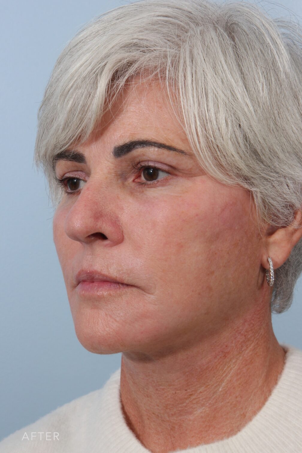 Facial Procedures Archives - Williams Center Williams Center